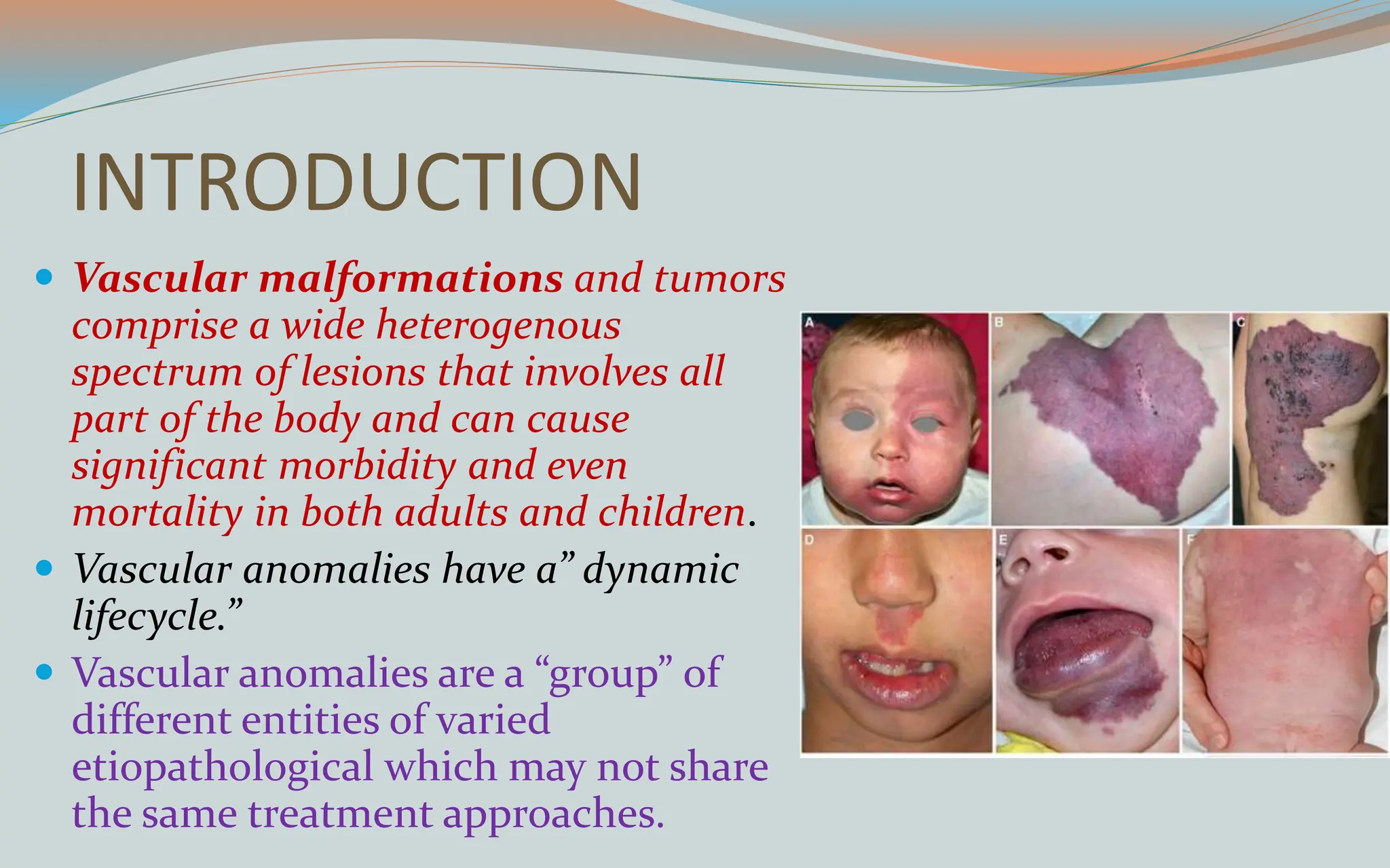VASCULAR MALFORMATION AND ITS MANAGEMENT.pptx