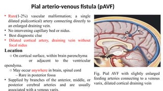VASCULAR MALFORMATION OF BRAIN RADIOLOGY.pptx