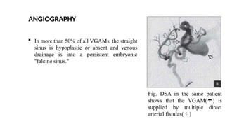 VASCULAR MALFORMATION OF BRAIN RADIOLOGY.pptx