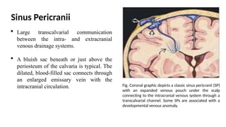 VASCULAR MALFORMATION OF BRAIN RADIOLOGY.pptx