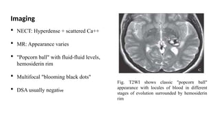 VASCULAR MALFORMATION OF BRAIN RADIOLOGY.pptx