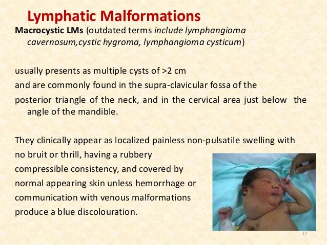 Vascular malformations