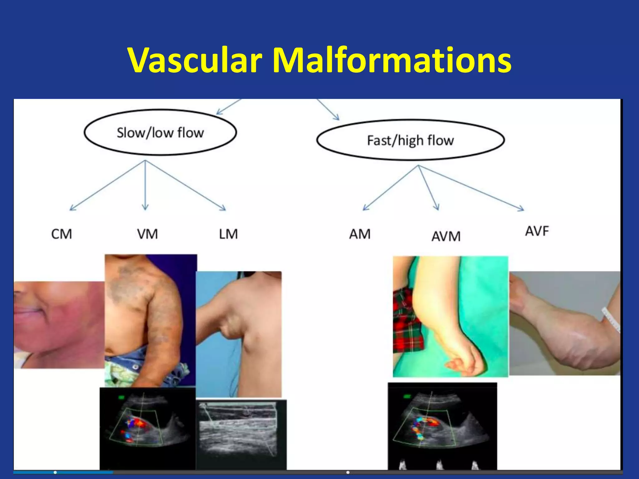 Vascular Anomalies: Vascular Tumours and Vascular malformations | PPTX