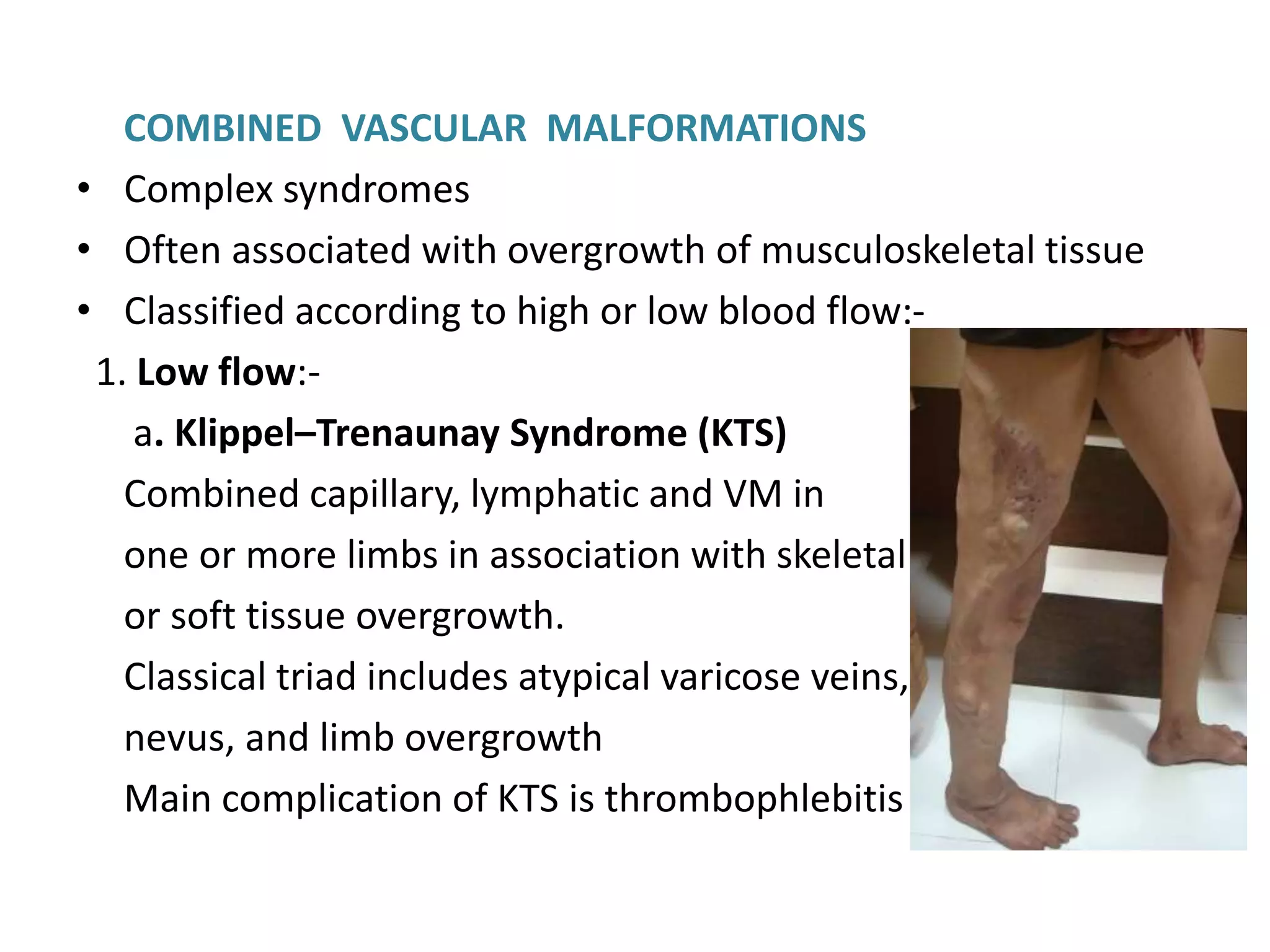 Vascular malformations | PPTX
