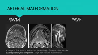 Vascular malformations of the head and neck | PPTX