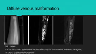 Vascular malformations of the head and neck | PPTX