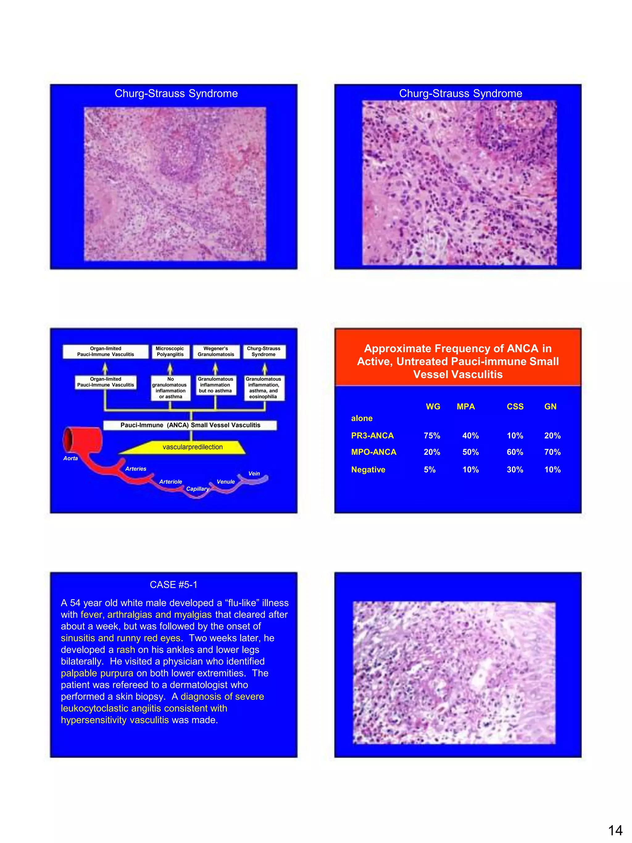 Vascular pathology | PPTX