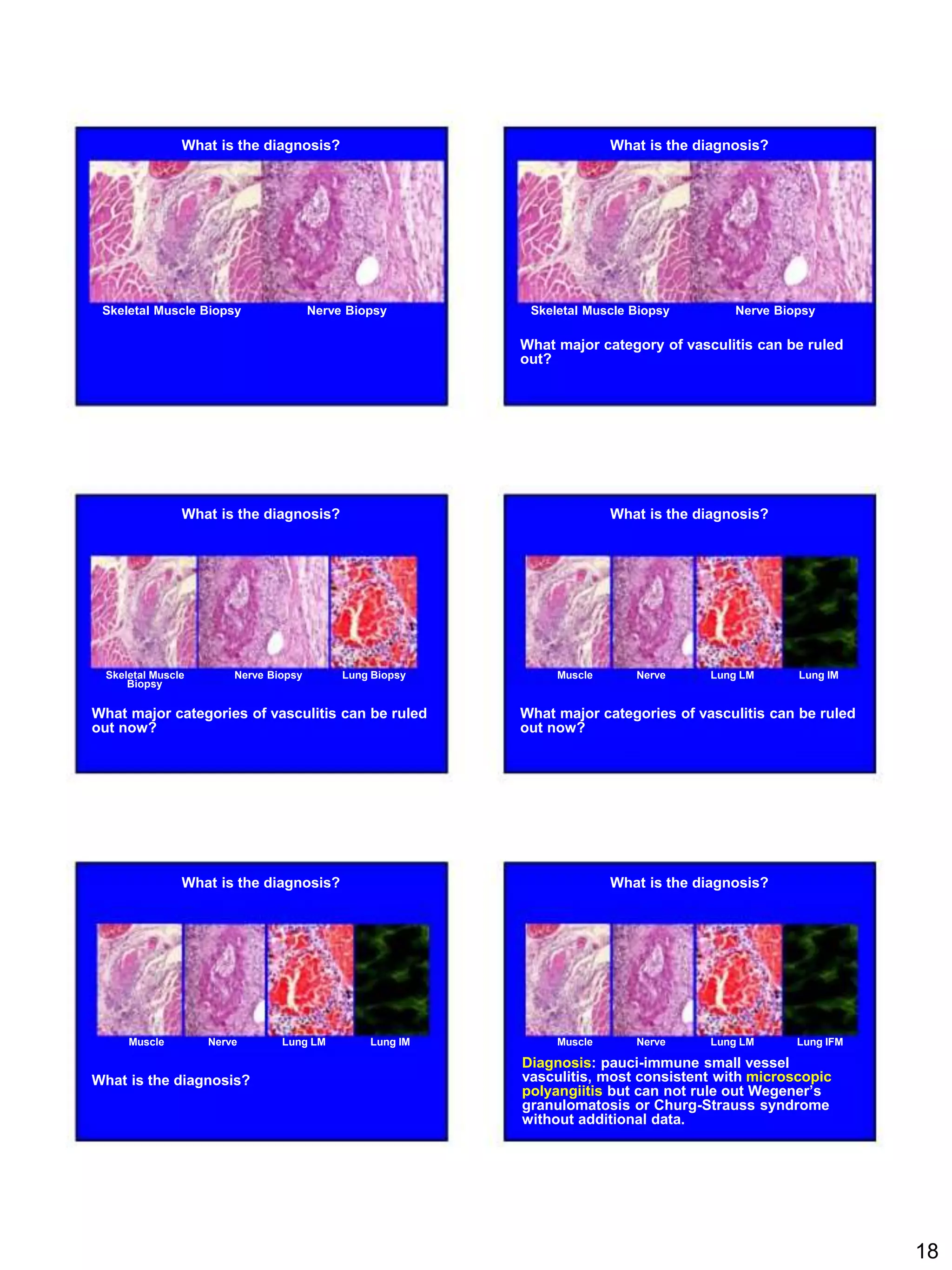 Vascular pathology | PPTX