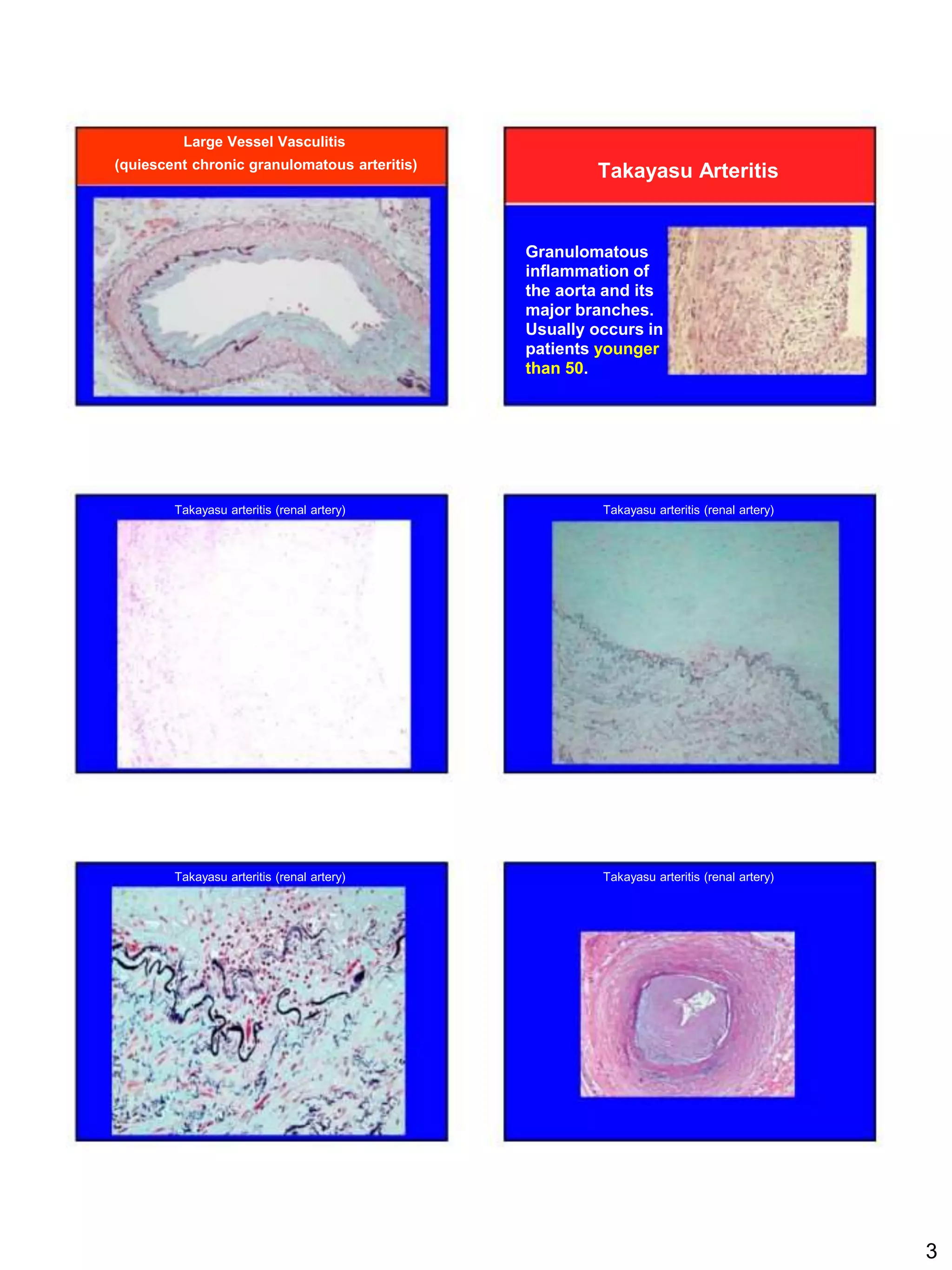 Vascular pathology | PPTX