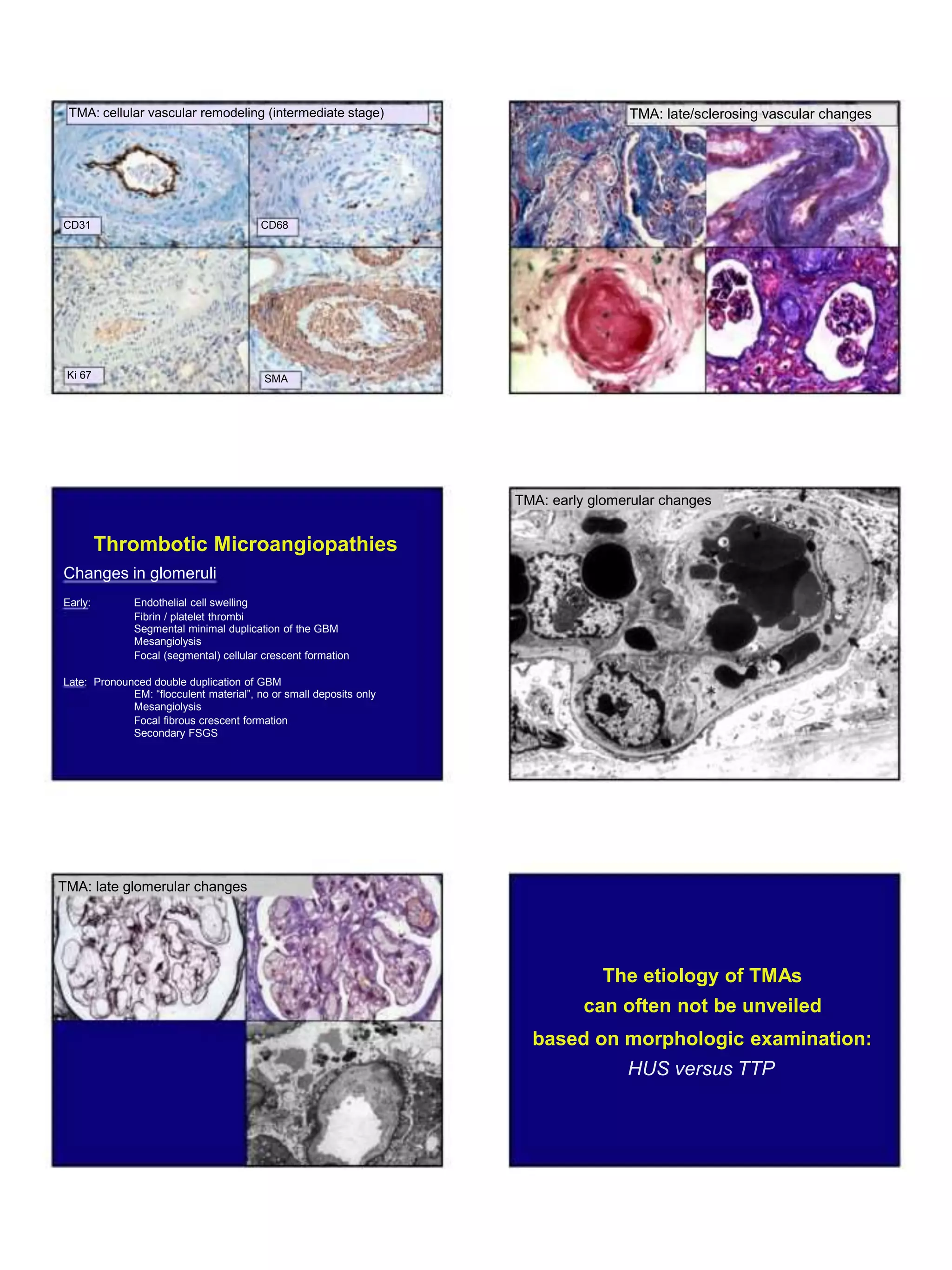 Vascular pathology | PPTX