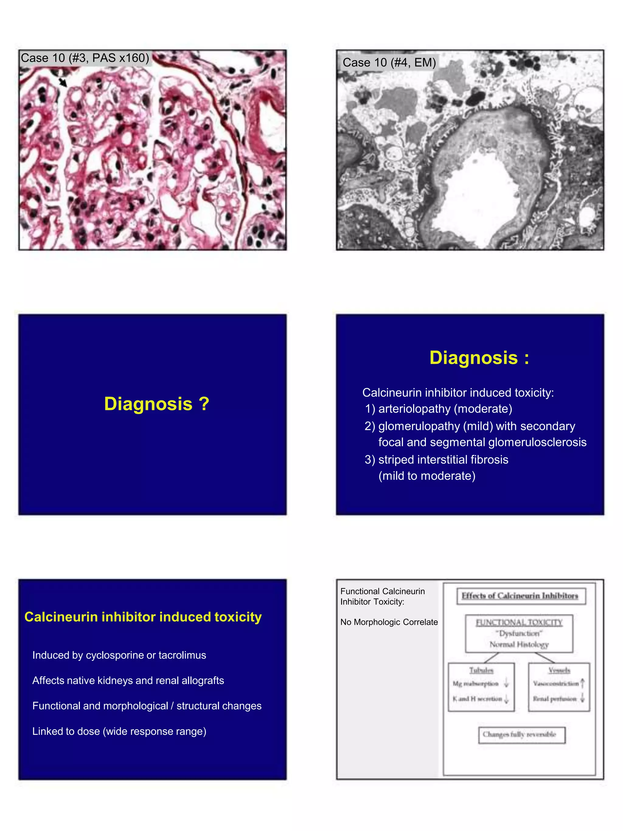 Vascular pathology | PPTX