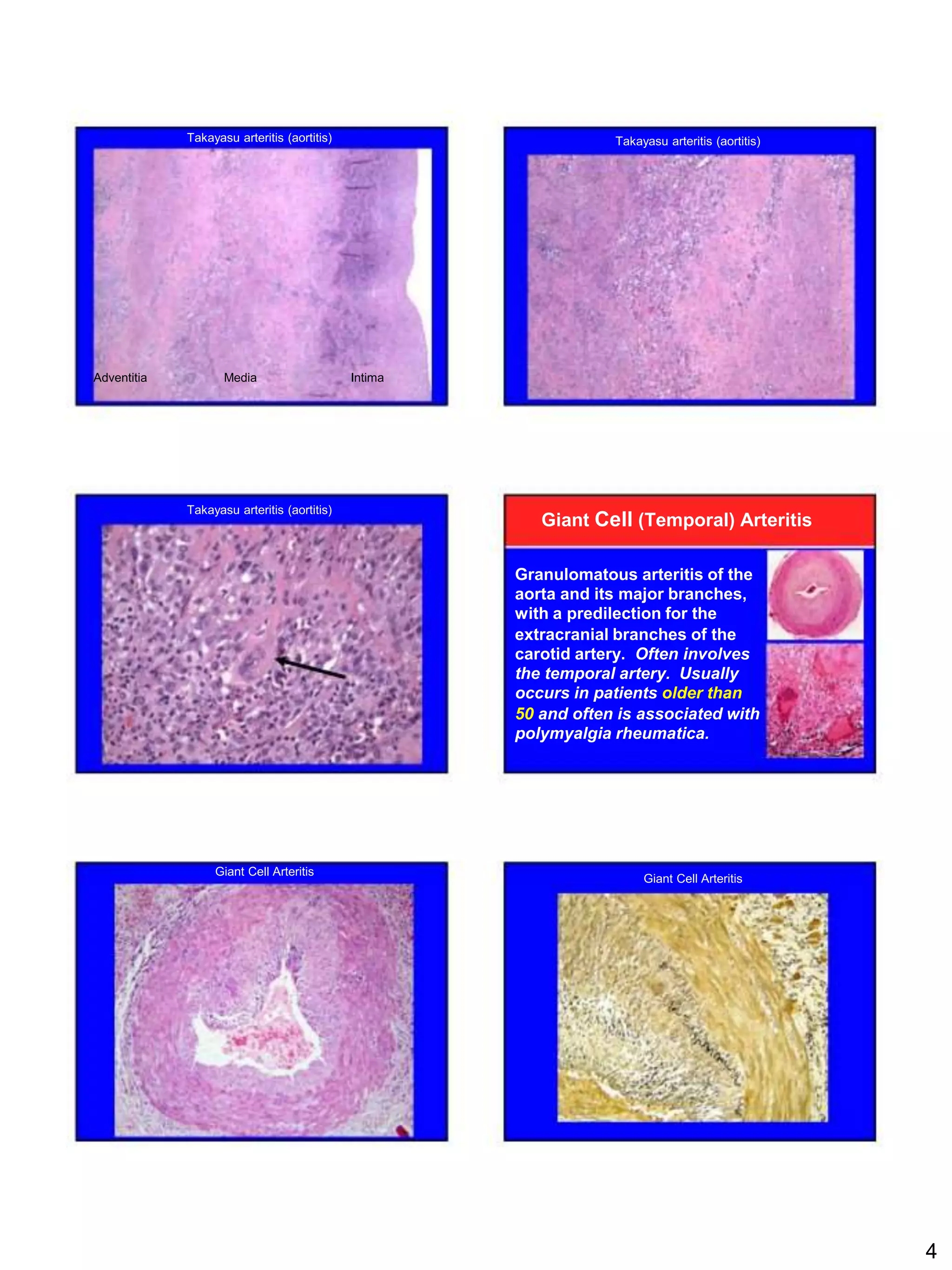 Vascular pathology | PPTX