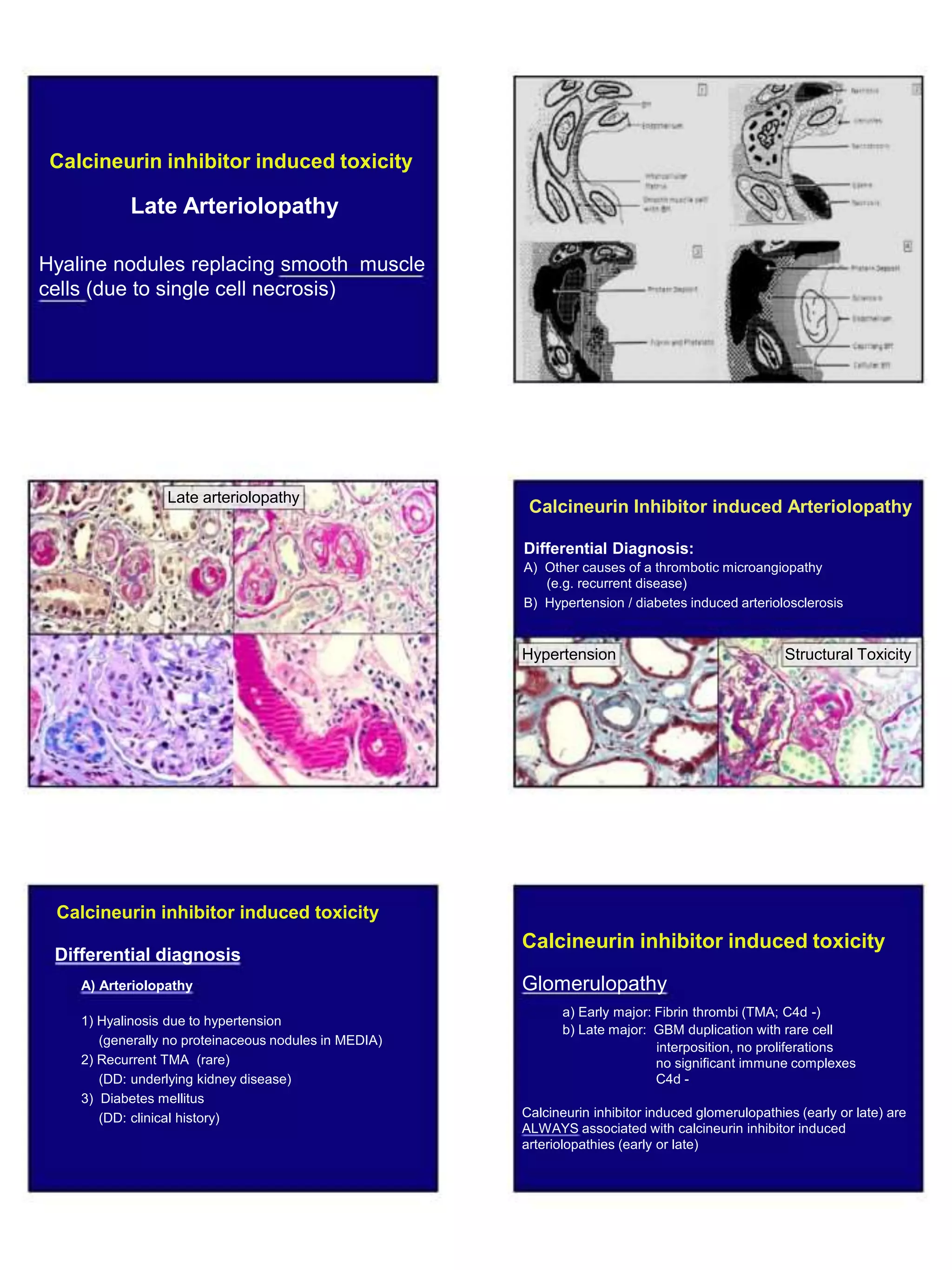 Vascular pathology | PPTX