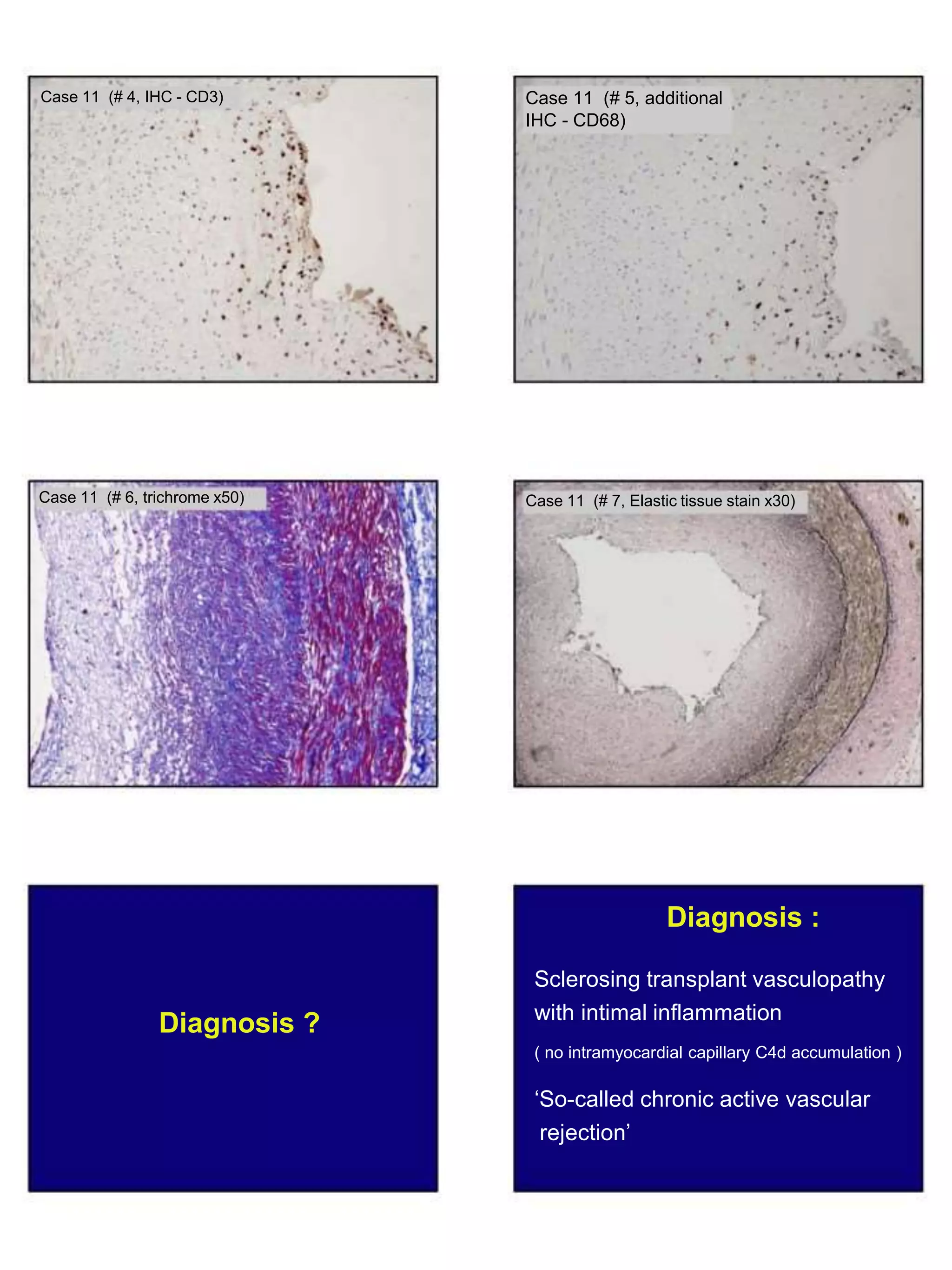 Vascular pathology | PPTX
