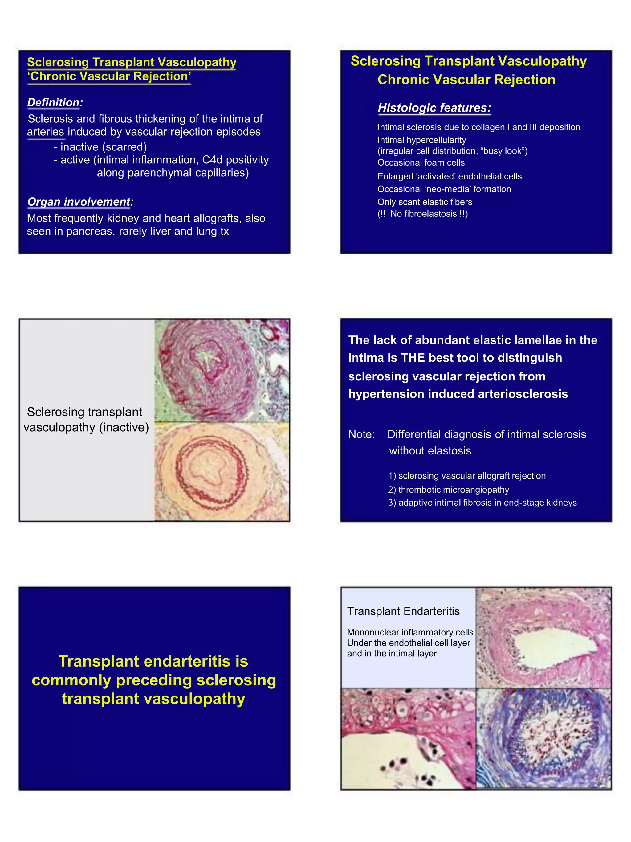 Vascular pathology | PPTX