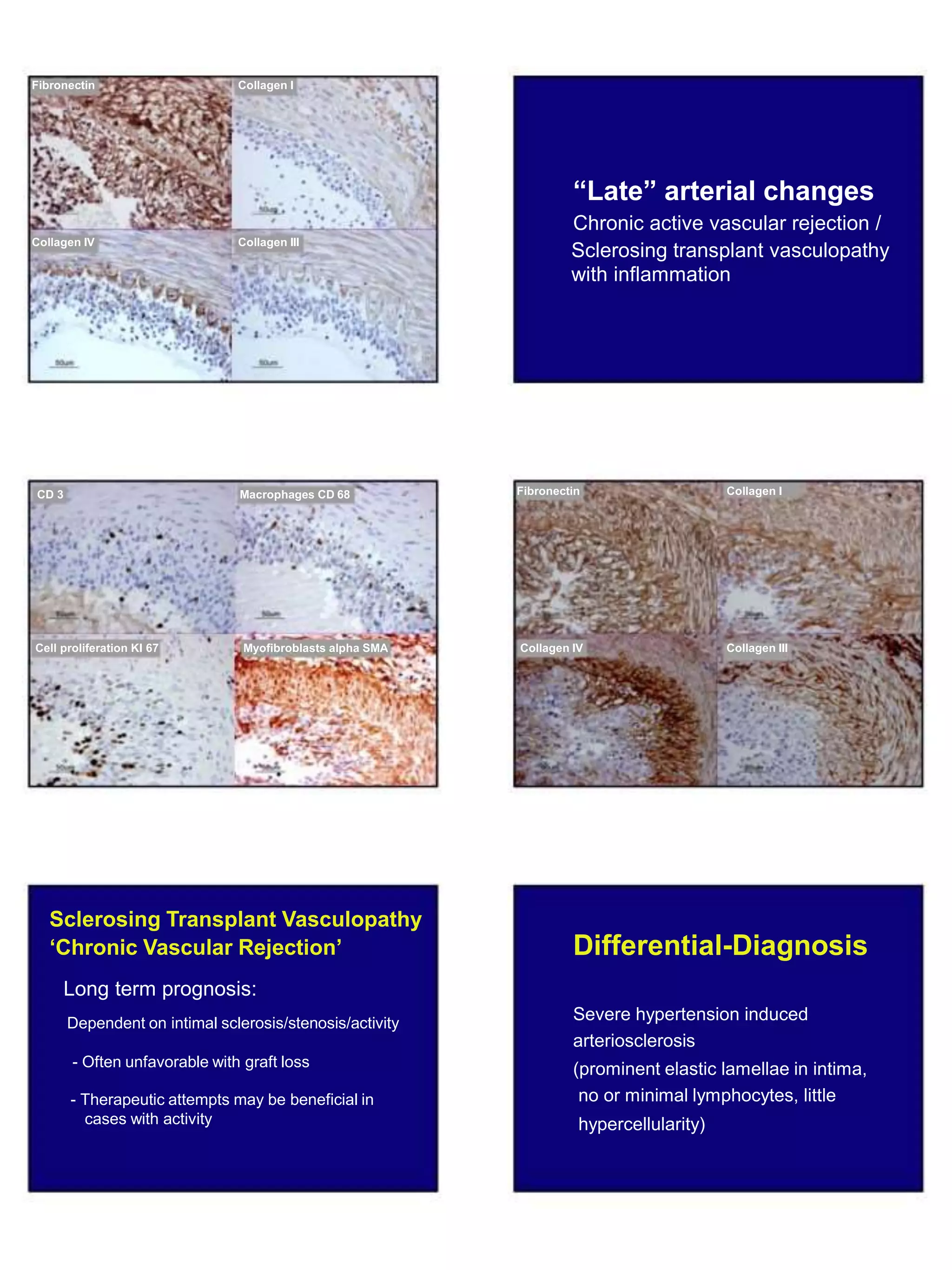 Vascular pathology | PPTX