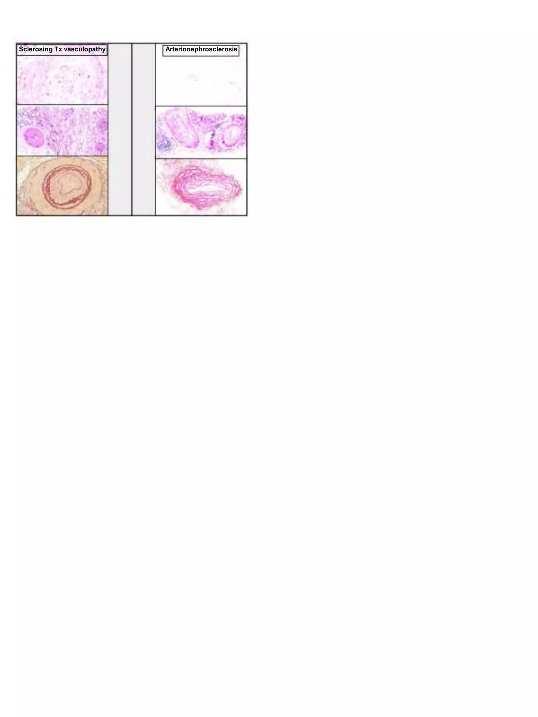 Vascular pathology | PPTX