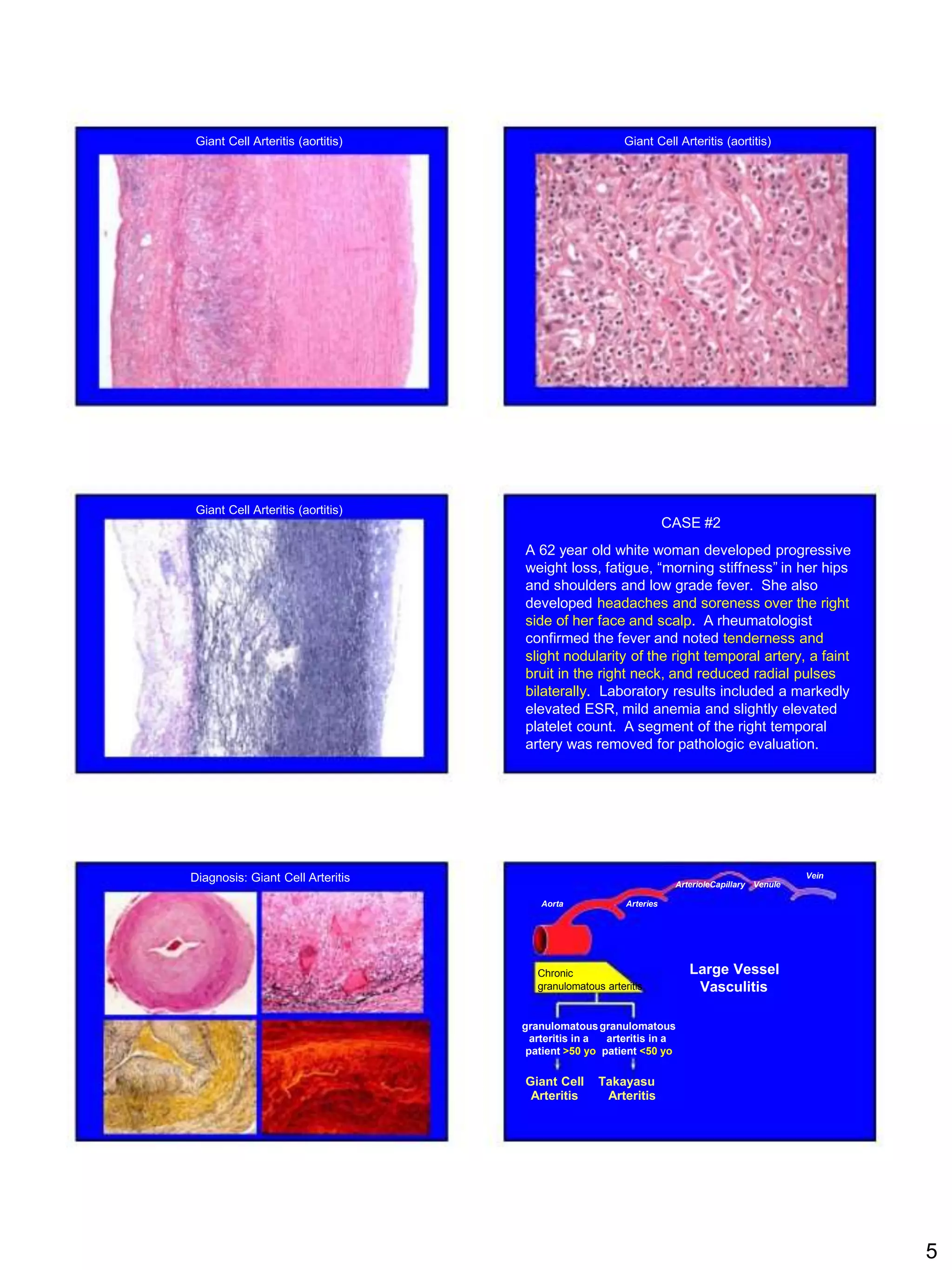 Vascular pathology | PPTX