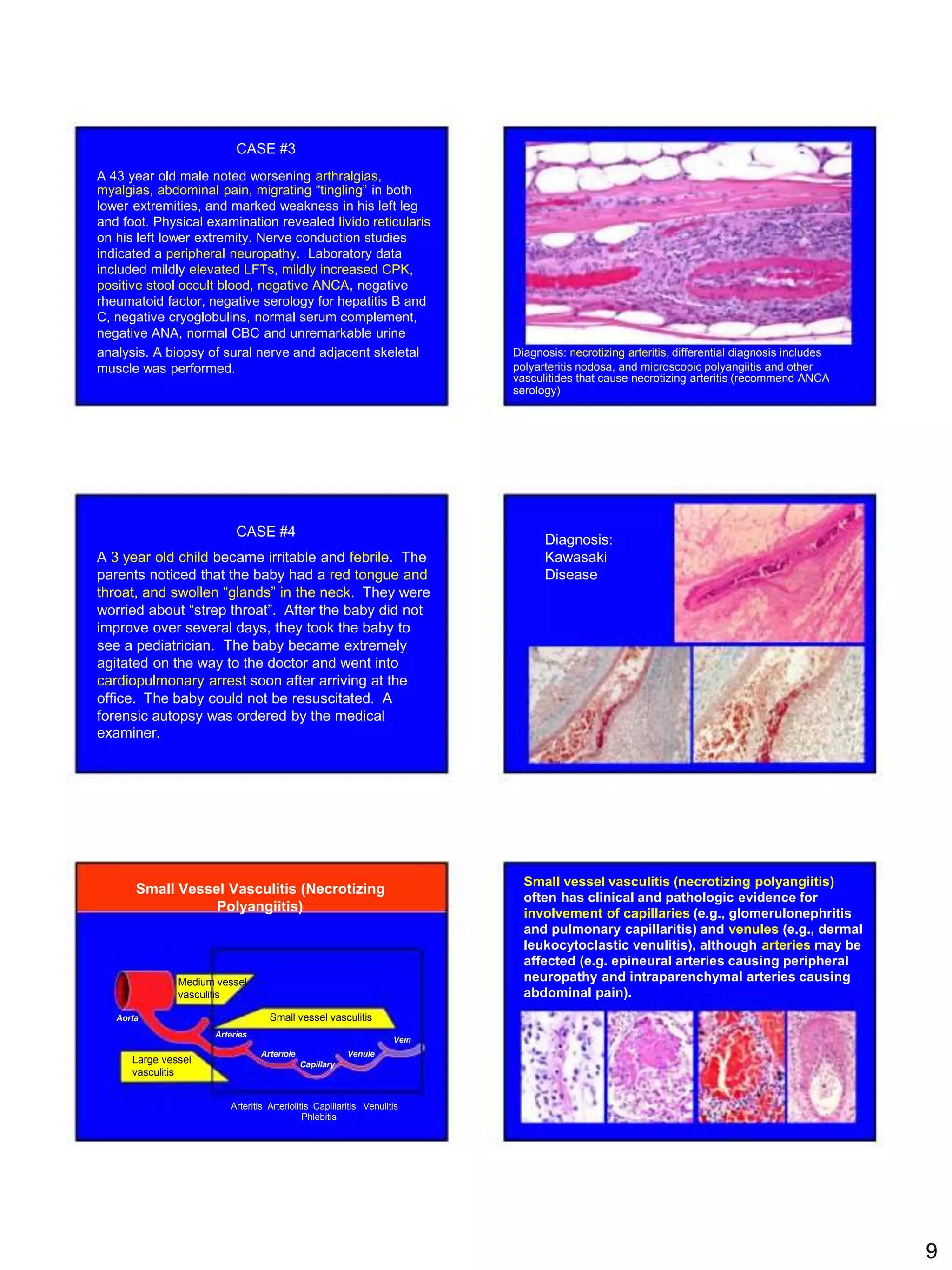 Vascular pathology | PPTX