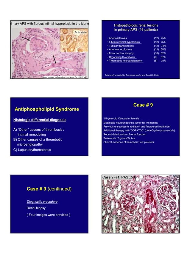 Vascular pathology | PDF