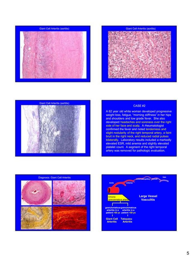 Vascular pathology | PDF
