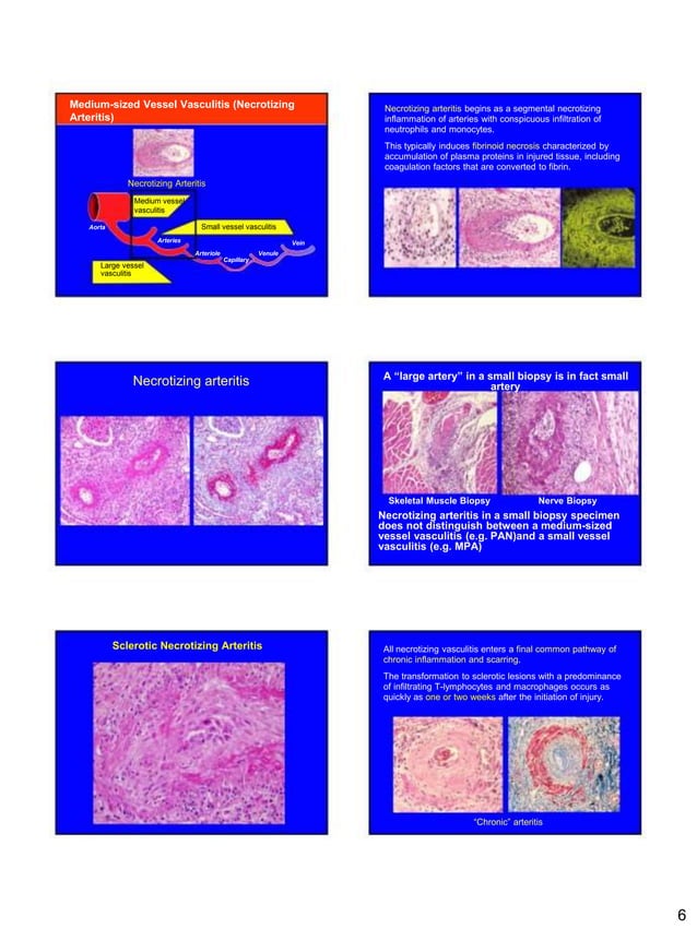 Vascular pathology | PDF