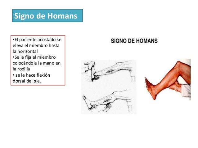 Semiología Médica del Sistema Vascular Periférico