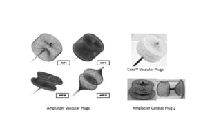 Vascular plugs | PPT