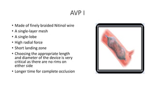 Vascular plugs | PPT