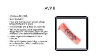 Vascular plugs | PPTX