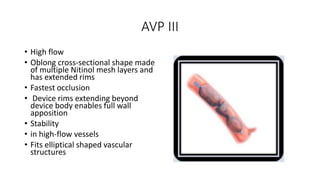 Vascular plugs | PPT