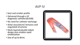 Vascular plugs | PPT