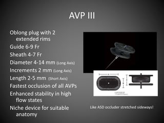Use of Vascular plugs in cardiovascular medicine | PPTX