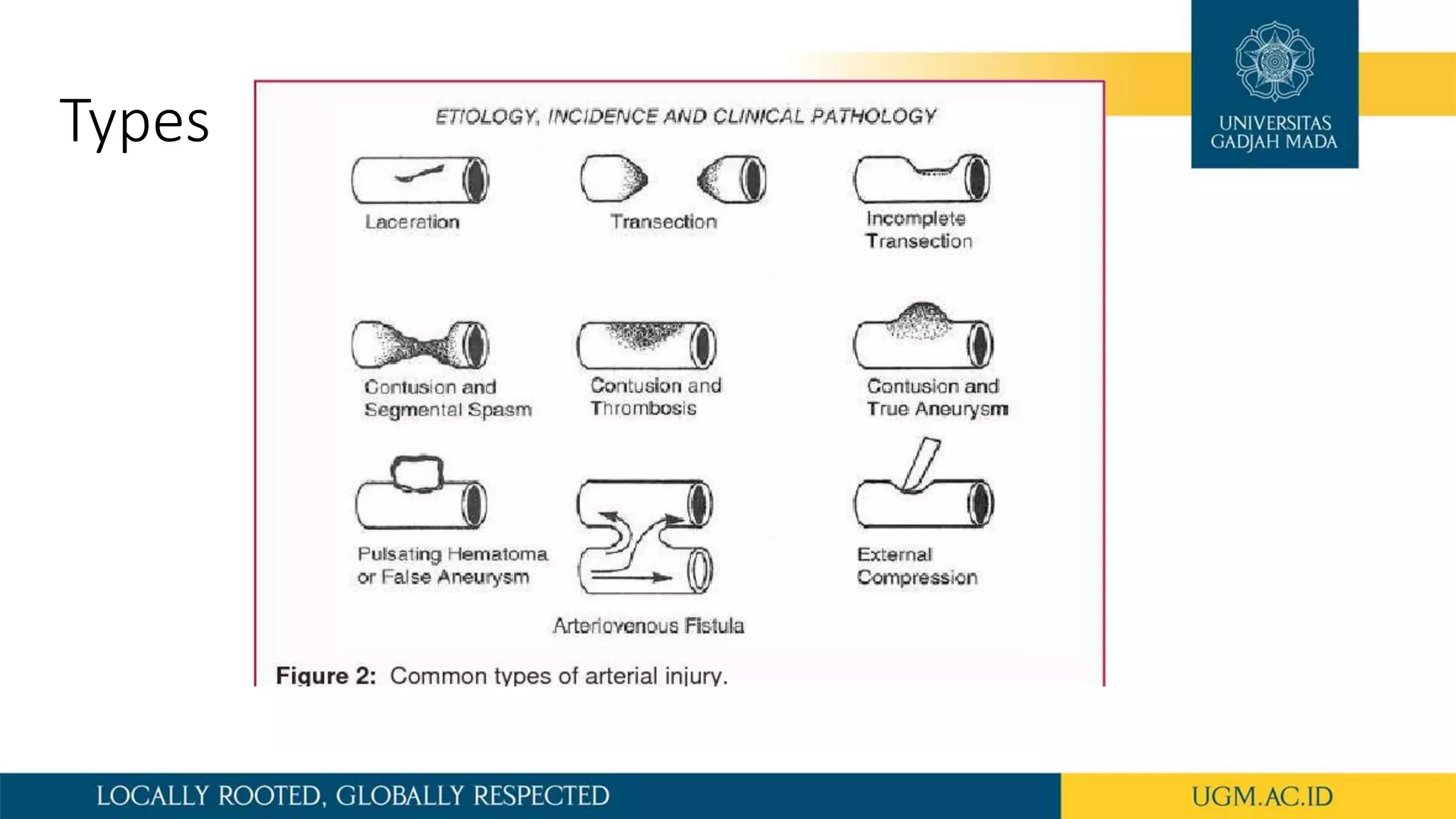 Vascular repair.pptx