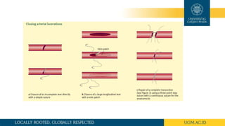 Vascular repair.pptx