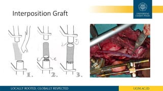 Vascular repair.pptx