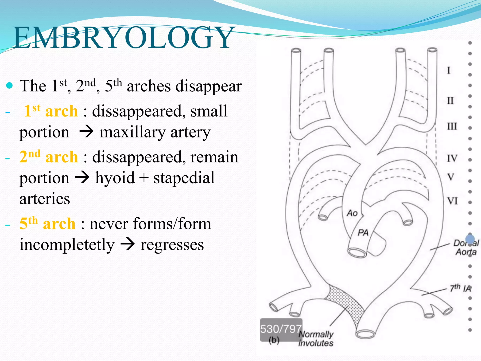 Vascular ring & Sling | PPTX
