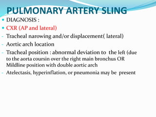 Vascular ring & Sling | PPTX