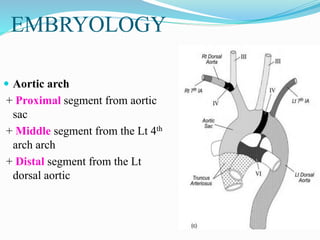 Vascular ring & Sling | PPTX
