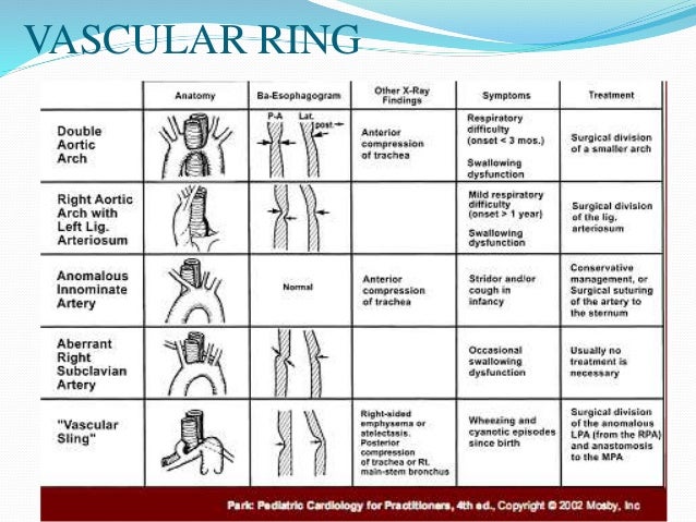 Vascular ring & Sling