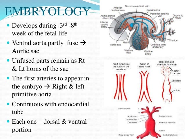 Vascular ring & Sling