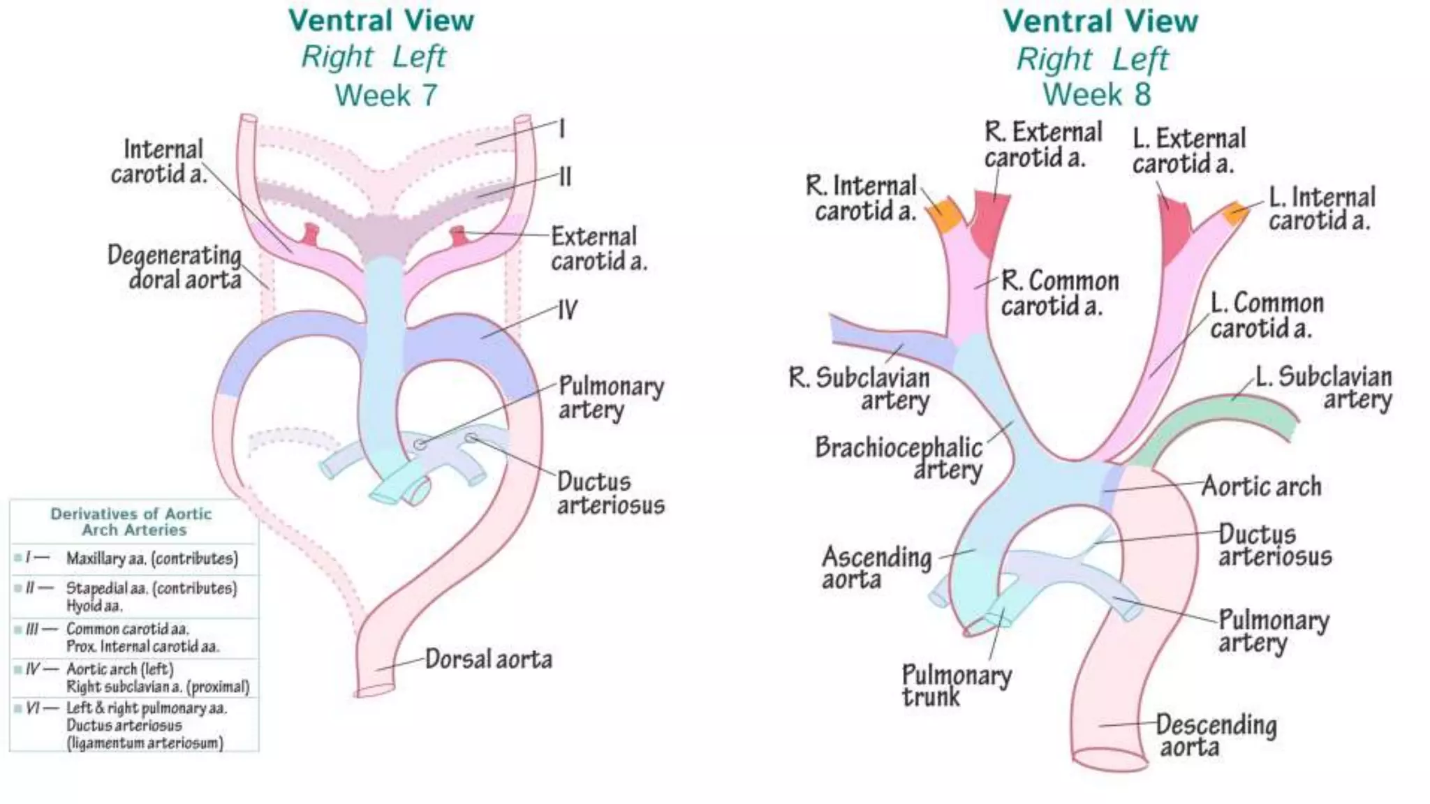 VASCULAR RINGS AND SLINGS TYPES HAEMODYNAMICS PRESENTATION AND ...