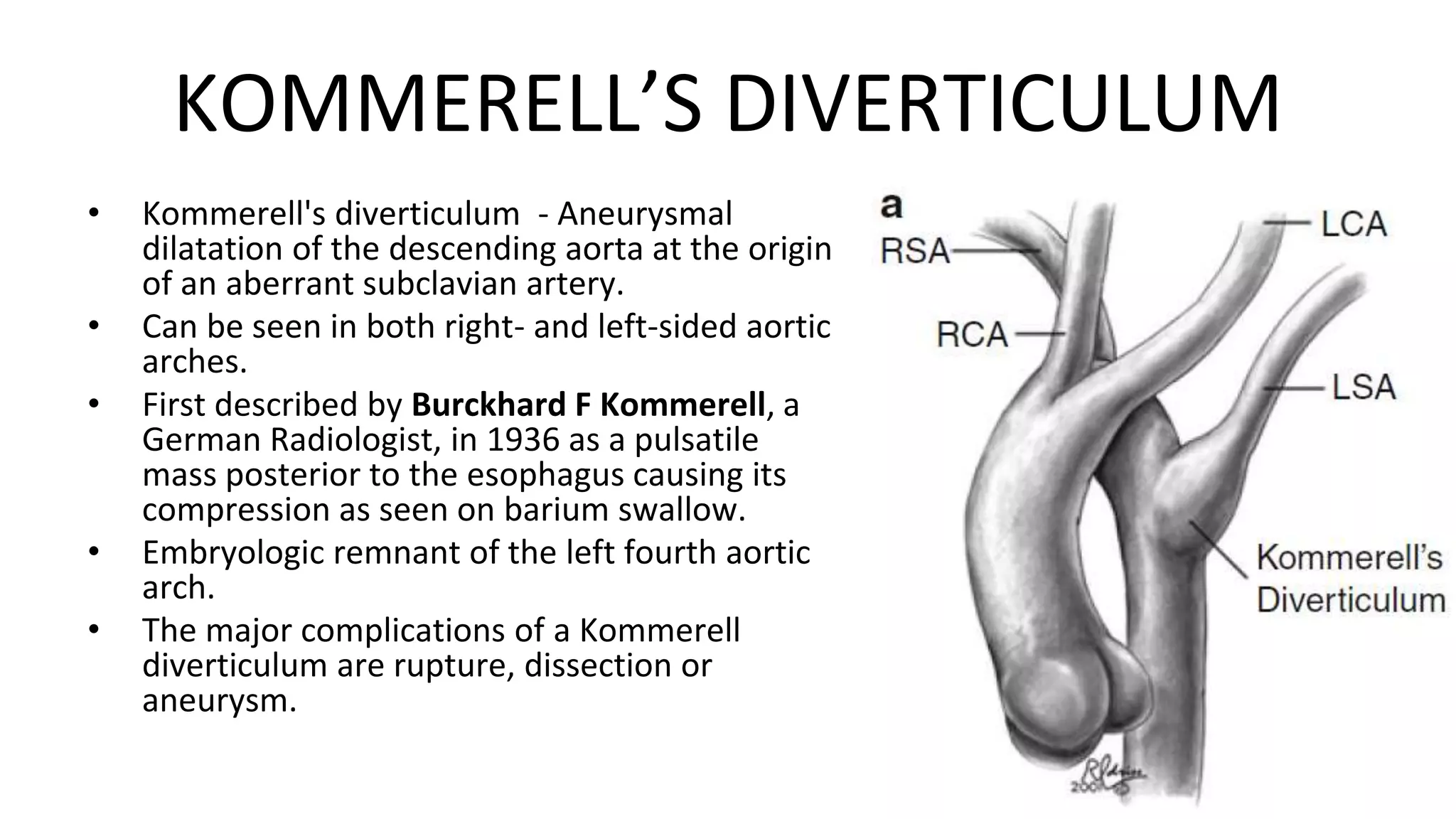 VASCULAR RINGS AND SLINGS TYPES HAEMODYNAMICS PRESENTATION AND ...