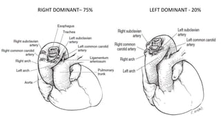 VASCULAR RINGS AND SLINGS TYPES HAEMODYNAMICS PRESENTATION AND ...