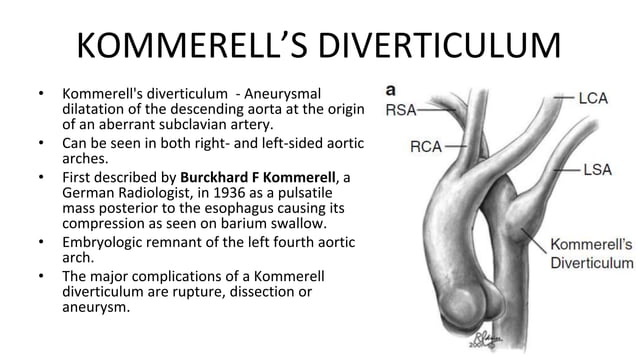 VASCULAR RINGS AND SLINGS TYPES HAEMODYNAMICS PRESENTATION AND ...