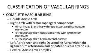 VASCULAR RINGS AND SLINGS TYPES HAEMODYNAMICS PRESENTATION AND ...