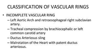 VASCULAR RINGS AND SLINGS TYPES HAEMODYNAMICS PRESENTATION AND ...