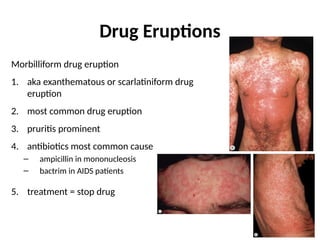 Vascular Skin Diseases_Mari-Alina Timoshchuk.pptx