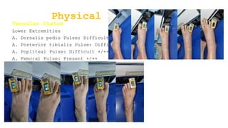 case of patient legs vascular status.pptx