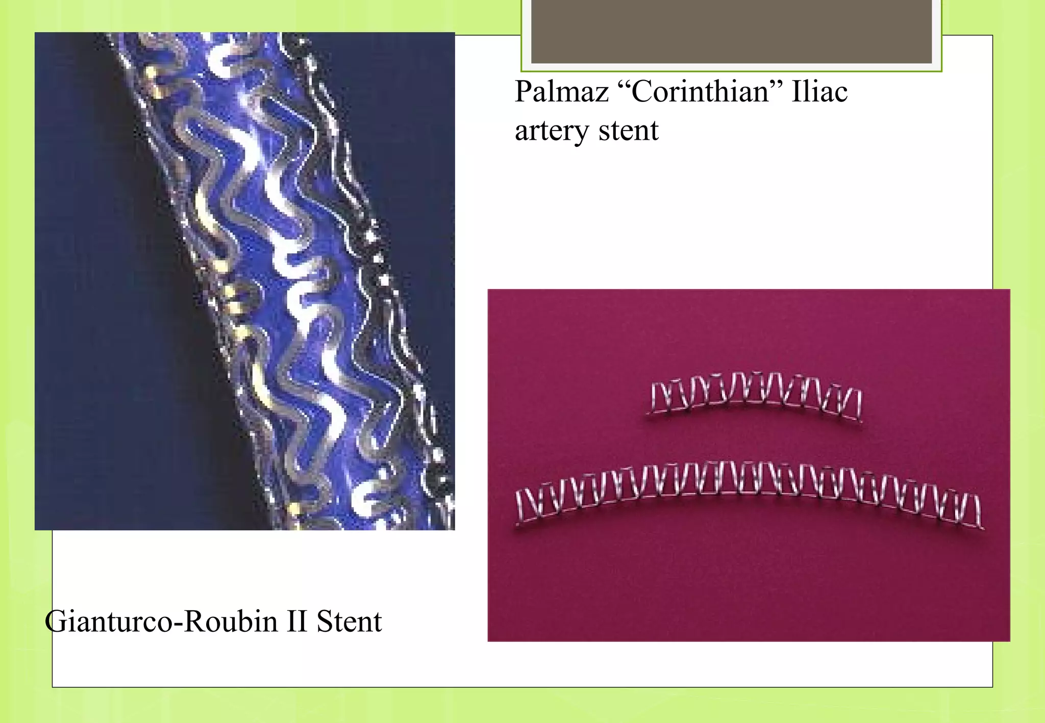 Vascular stents | PPT